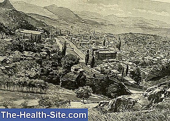 Akromegalija - Eerie Transformacija 💊 Znanstveno-Praktični Medical ...
