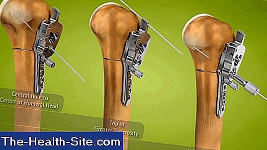 Humerus: Fungsi, Anatomi Dan Penyakit 💊 Ilmiah-Praktis Medical Journal ...