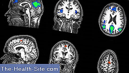 Fmrt - Memvisualisasikan Aktivitas Otak 💊 Ilmiah-Praktis Medical ...