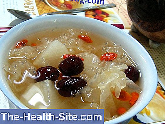 Viêm Amidan Mãn Tính: Triệu Chứng, Nguyên Nhân, Trị Liệu 💊 TạP Chí Y ...